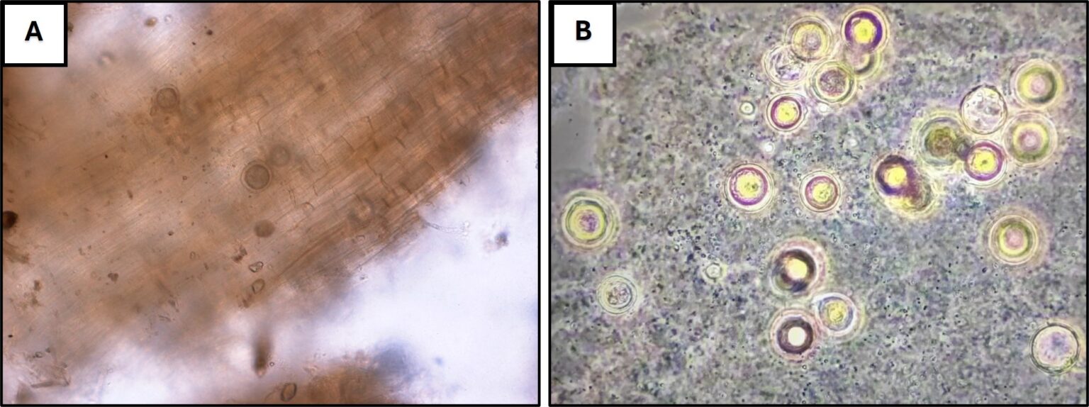 Phytophthora Crown and Stem Rot in Soybean: A Recurrent Disease in ...